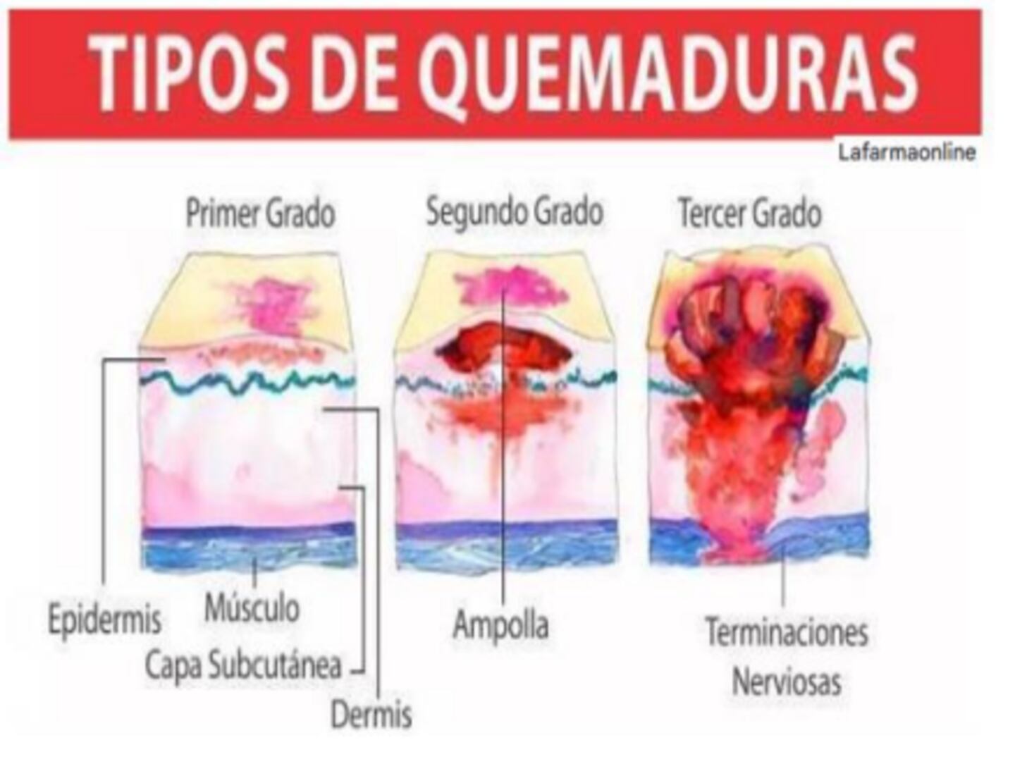 ¡Cuidado con el fuego! Lo que no te dijeron de la "Quema del Diablo" y cómo protegerte – Publinews